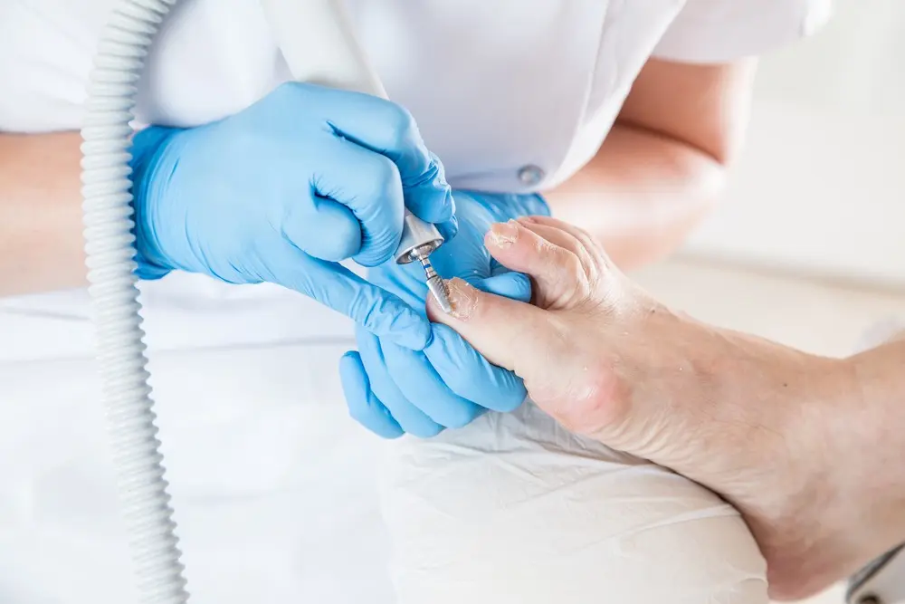 Toenail trauma : symptoms and treatments | PiedRéseau