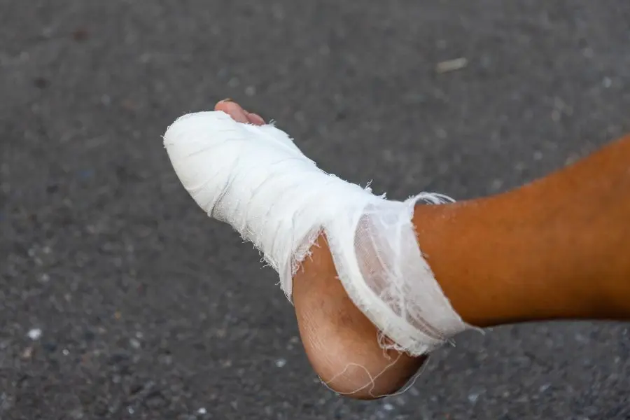 Partial or complete foot amputation | PiedRéseau